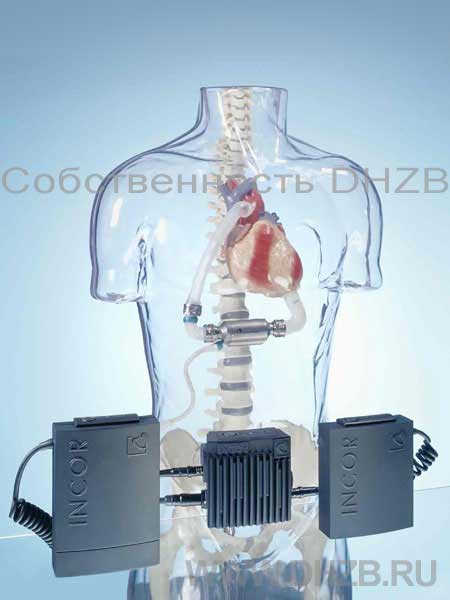 THE WORLD'S FIRST ARTIFICIAL CIRCULATORY DEVICE (ACV) “AUTOJECTOR” S.S ...
