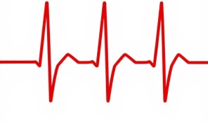 Ventricular extrasystole » CardioPlanet - professional information ...