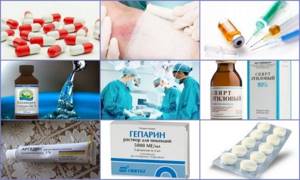 Флебит (воспаление) вены на руке: лечение, симптомы, фото нарушения